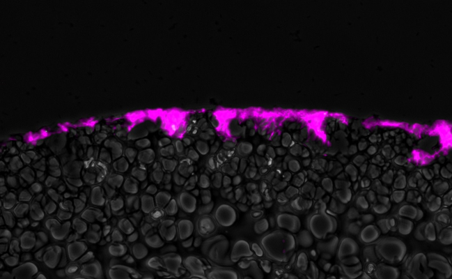 Complex coacervates – Polymer Science